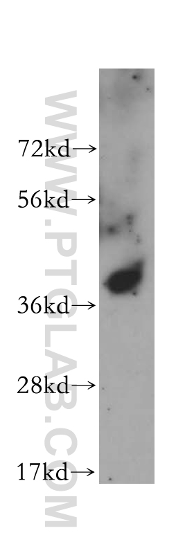 ALDOA Antibody 11217-1-AP | Proteintech ALDOA Antibody 11217-1-AP | Proteintech