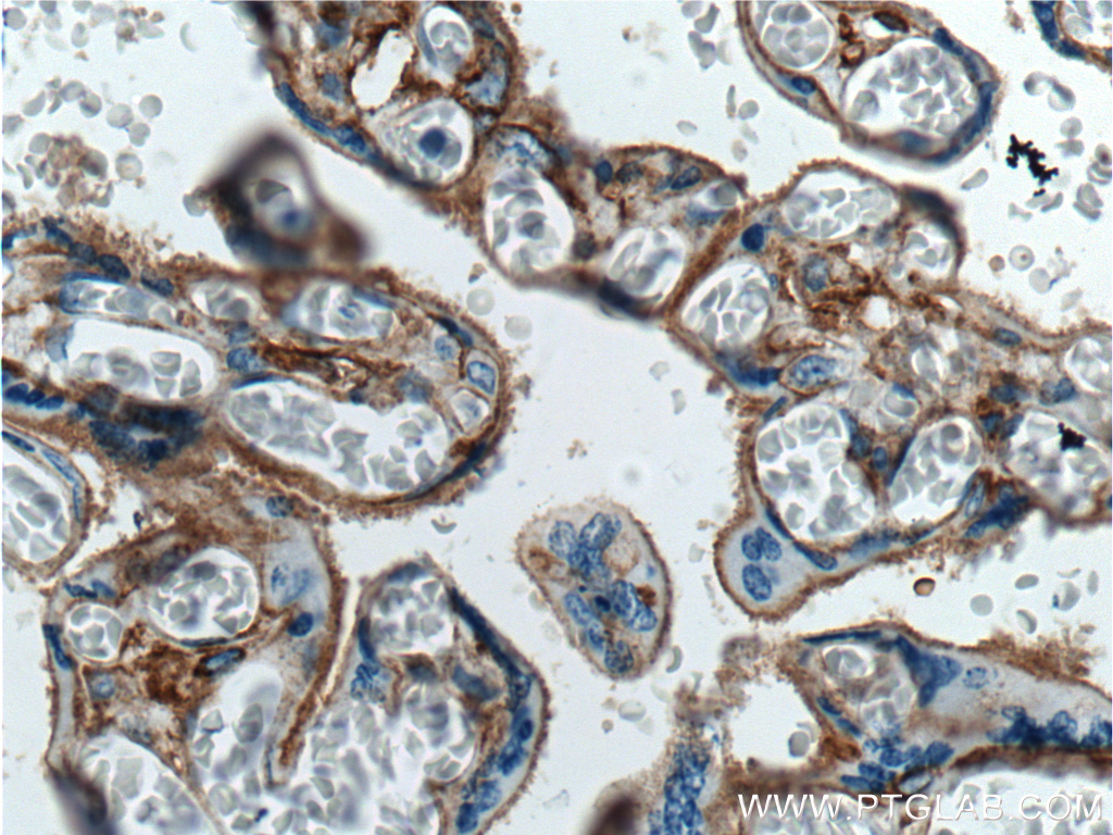 B7 H3 Antibody 66481 1 Ig Proteintech