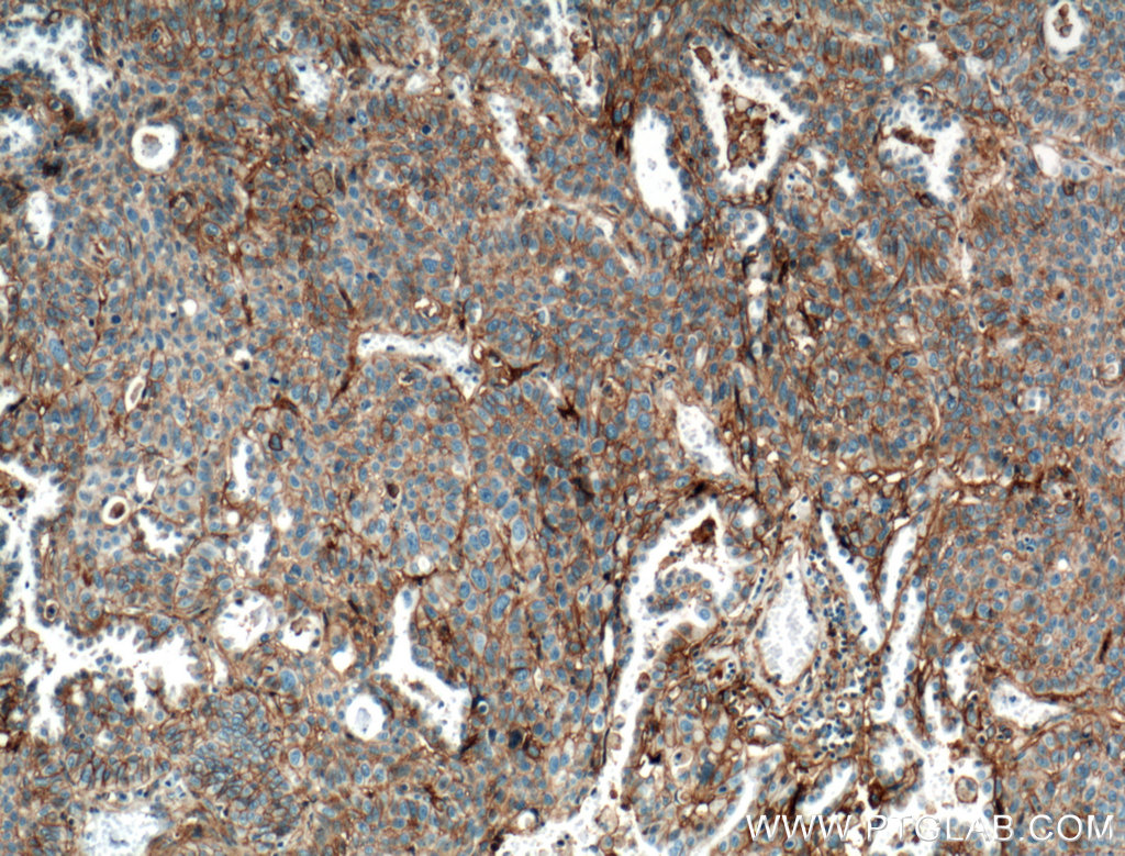 B7 H3 Antibody 66481 1 Ig Proteintech