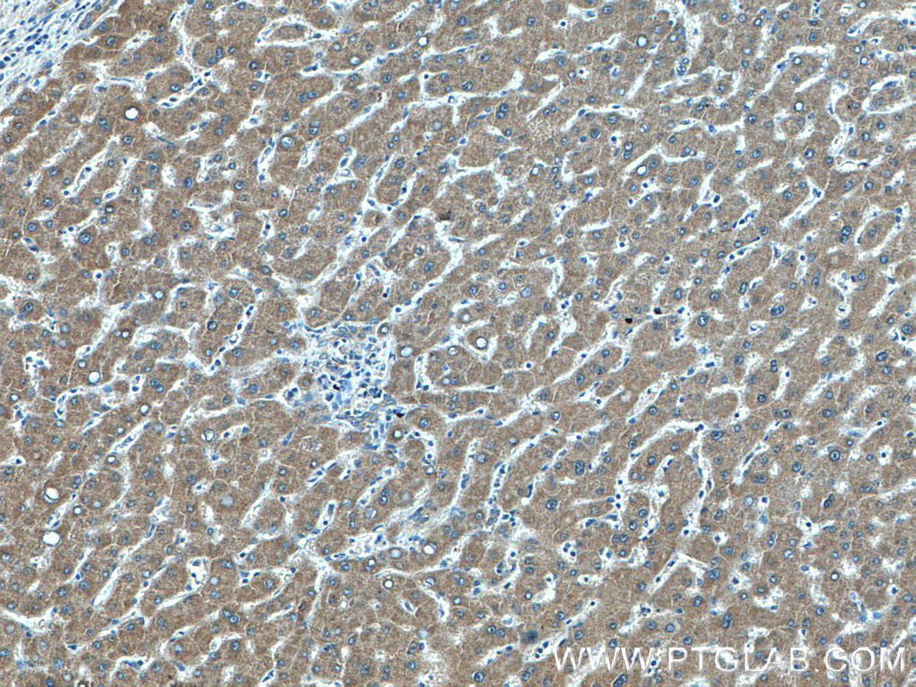 Choline Kinase Alpha Antibody 13520-1-AP | Proteintech