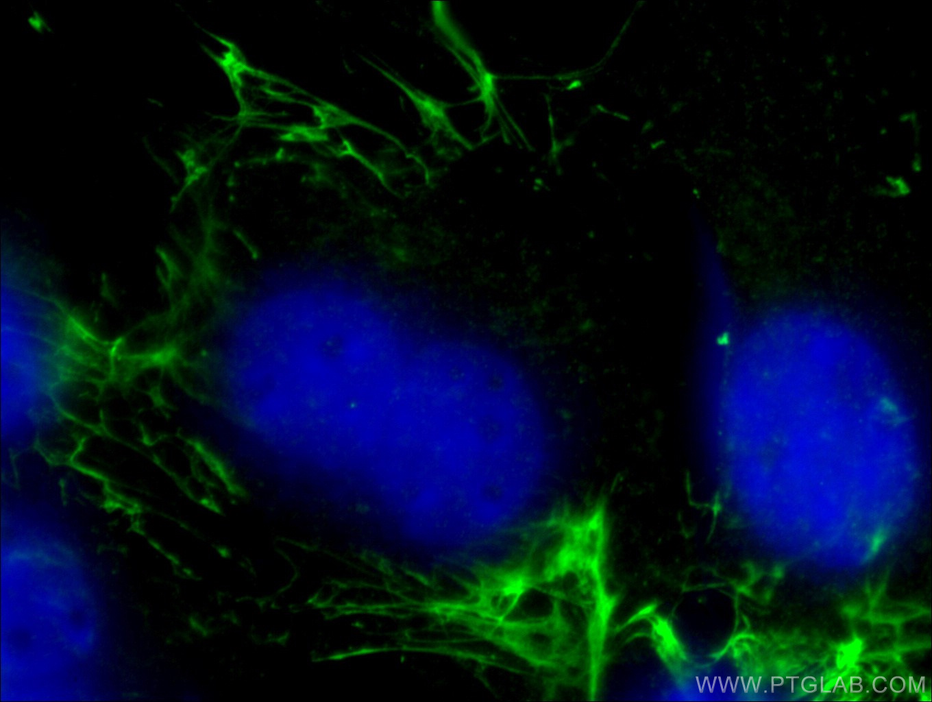 Fibronectin Antibody 66042 1 Ig Proteintech