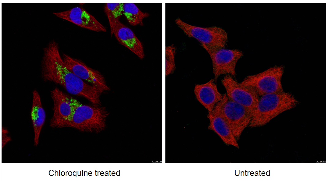 LC3 Antibody 14600-1-AP | Proteintech