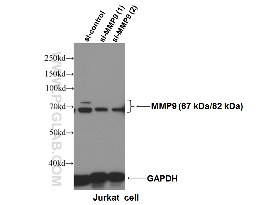 MMP9 (N-terminal) Antibody 10375-2-AP | Proteintech