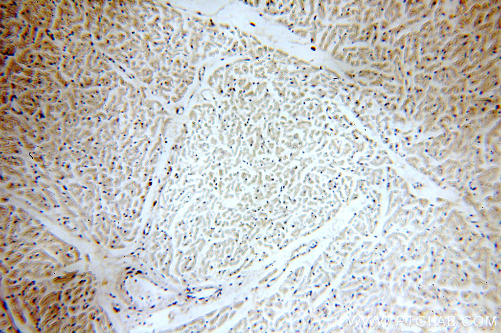 Sln Antibody 18395 1 Ap Proteintech