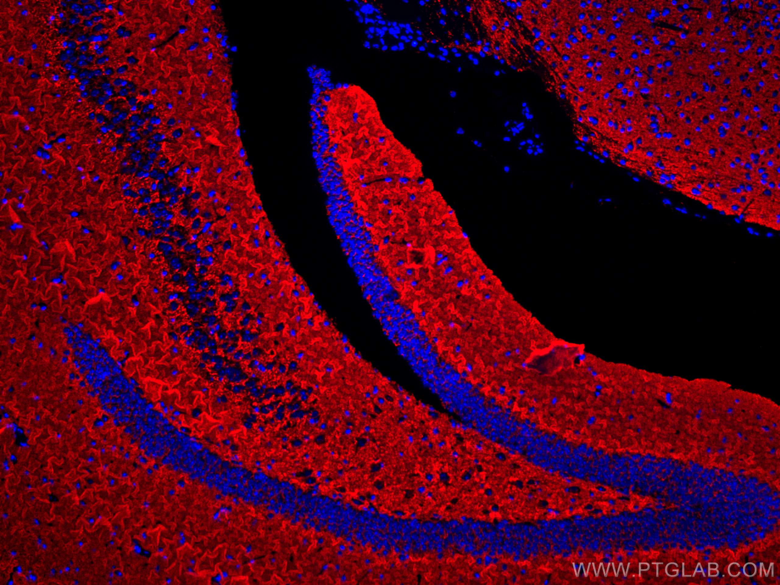 Synaptophysin Antibody CL594-67864 | Proteintech Synaptophysin Antibody CL594-67864 | Proteintech