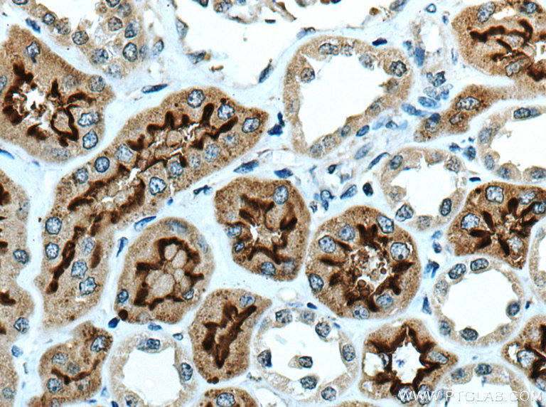 ACE2 Antibody 21115-1-AP | Proteintech