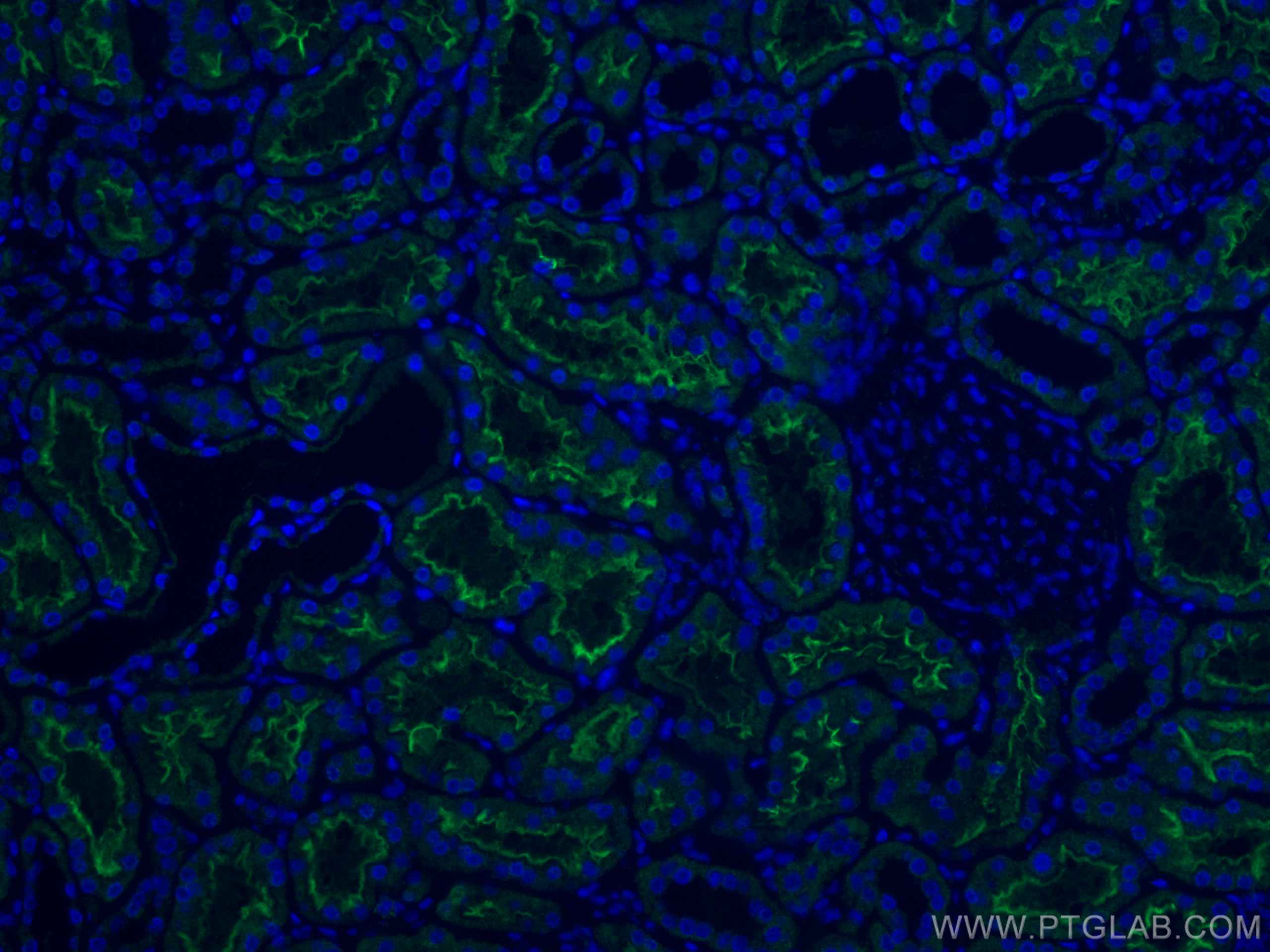 ACE2 Antibody 66699-1-Ig | Proteintech
