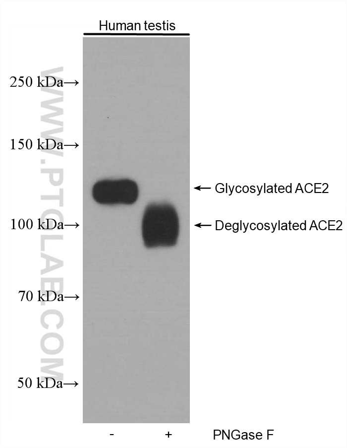 ACE2 Antibody 66699-1-Ig | Proteintech