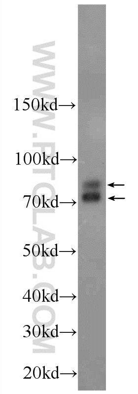 ACSL4/FACL4 Antibody 22401-1-AP | Proteintech