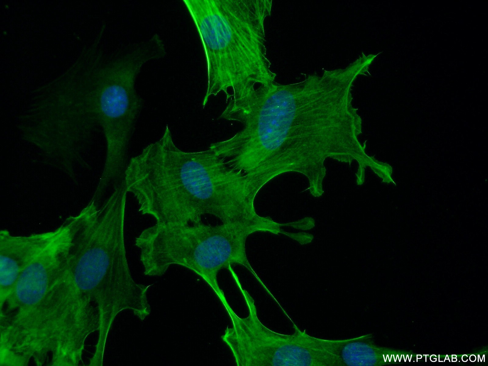 smooth muscle actin Antibody 14395-1-AP | Proteintech