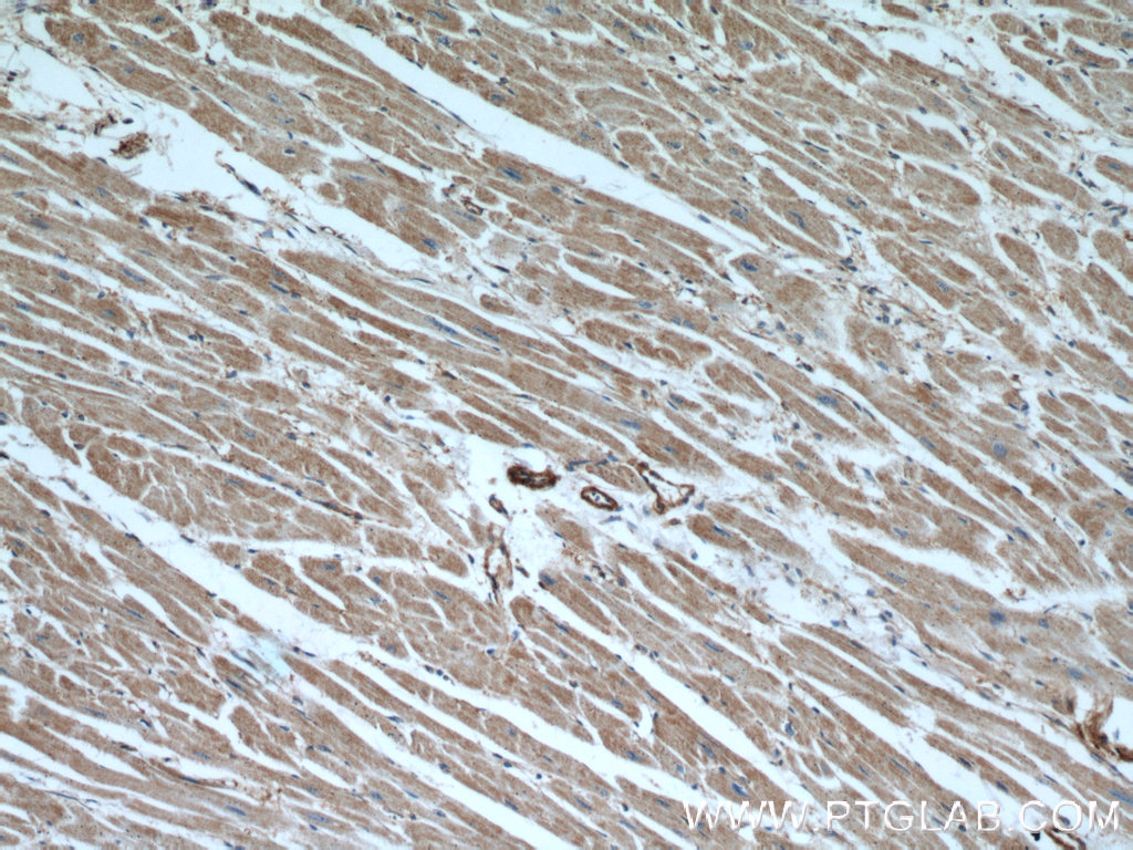 beta Actin Antibody 20536-1-AP | Proteintech