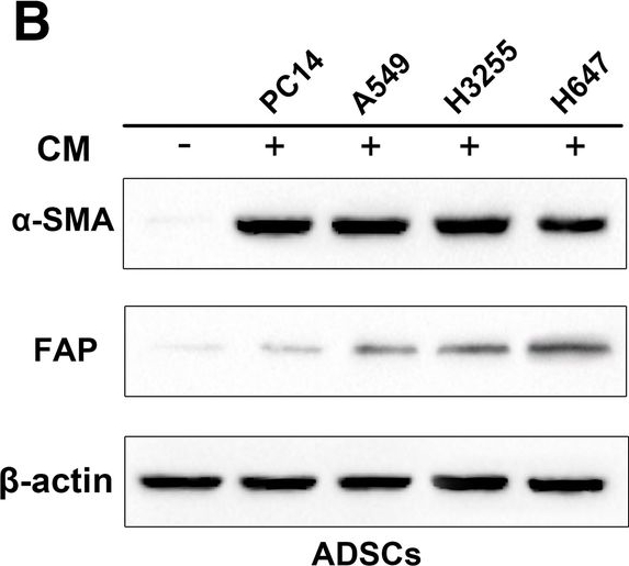 beta Actin Antibody 20536-1-AP | Proteintech