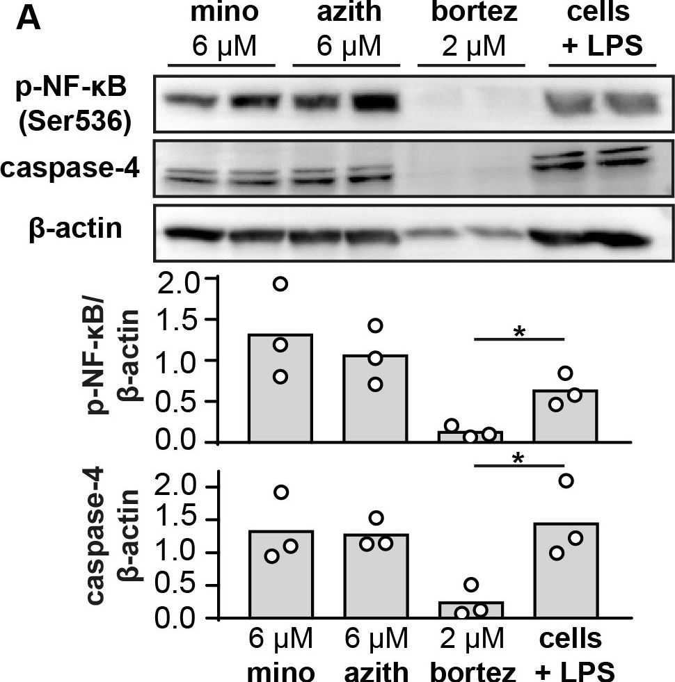 beta Actin Antibody 20536-1-AP | Proteintech