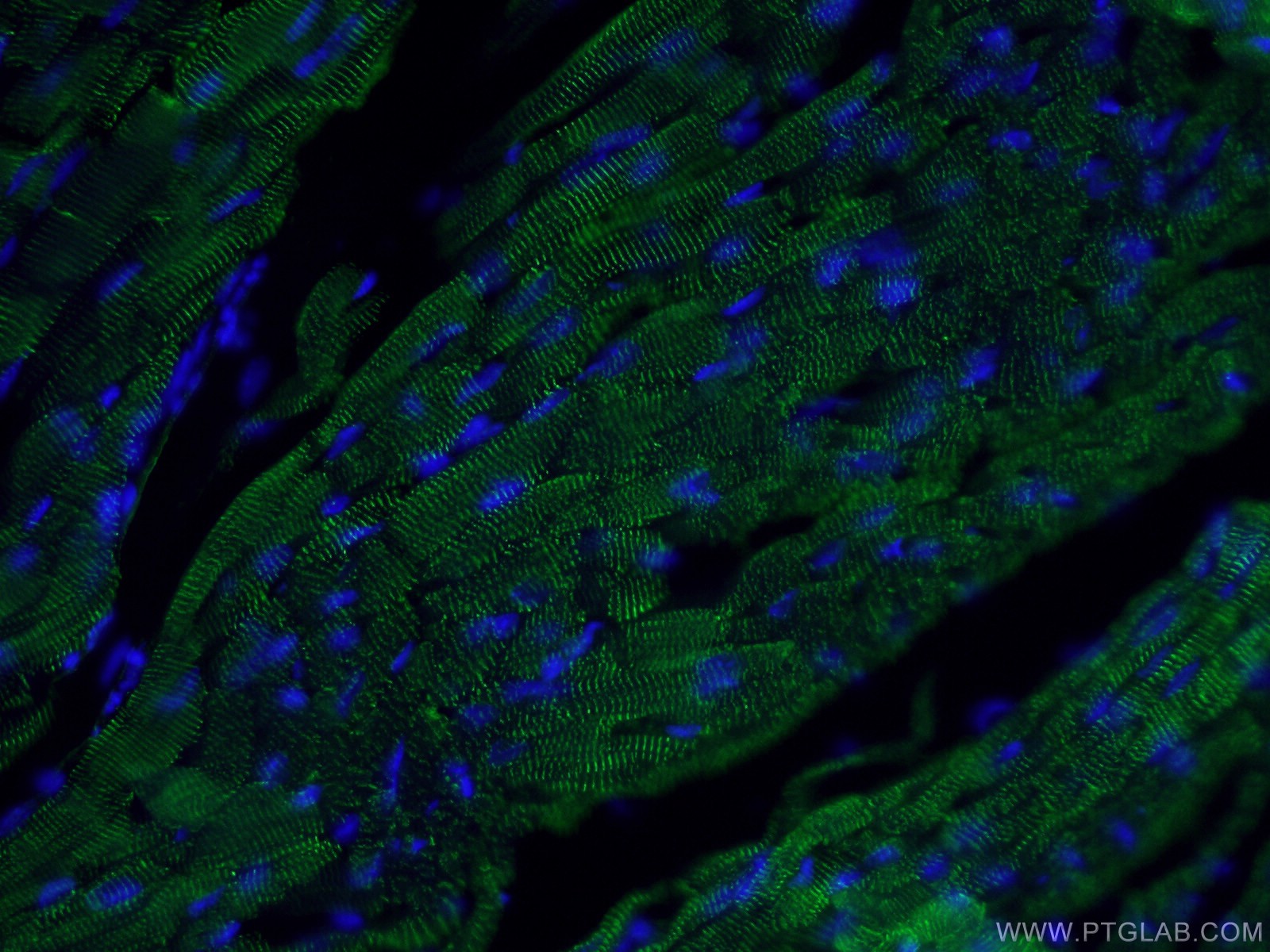 ACTN2 Antibody 14221-1-AP | Proteintech