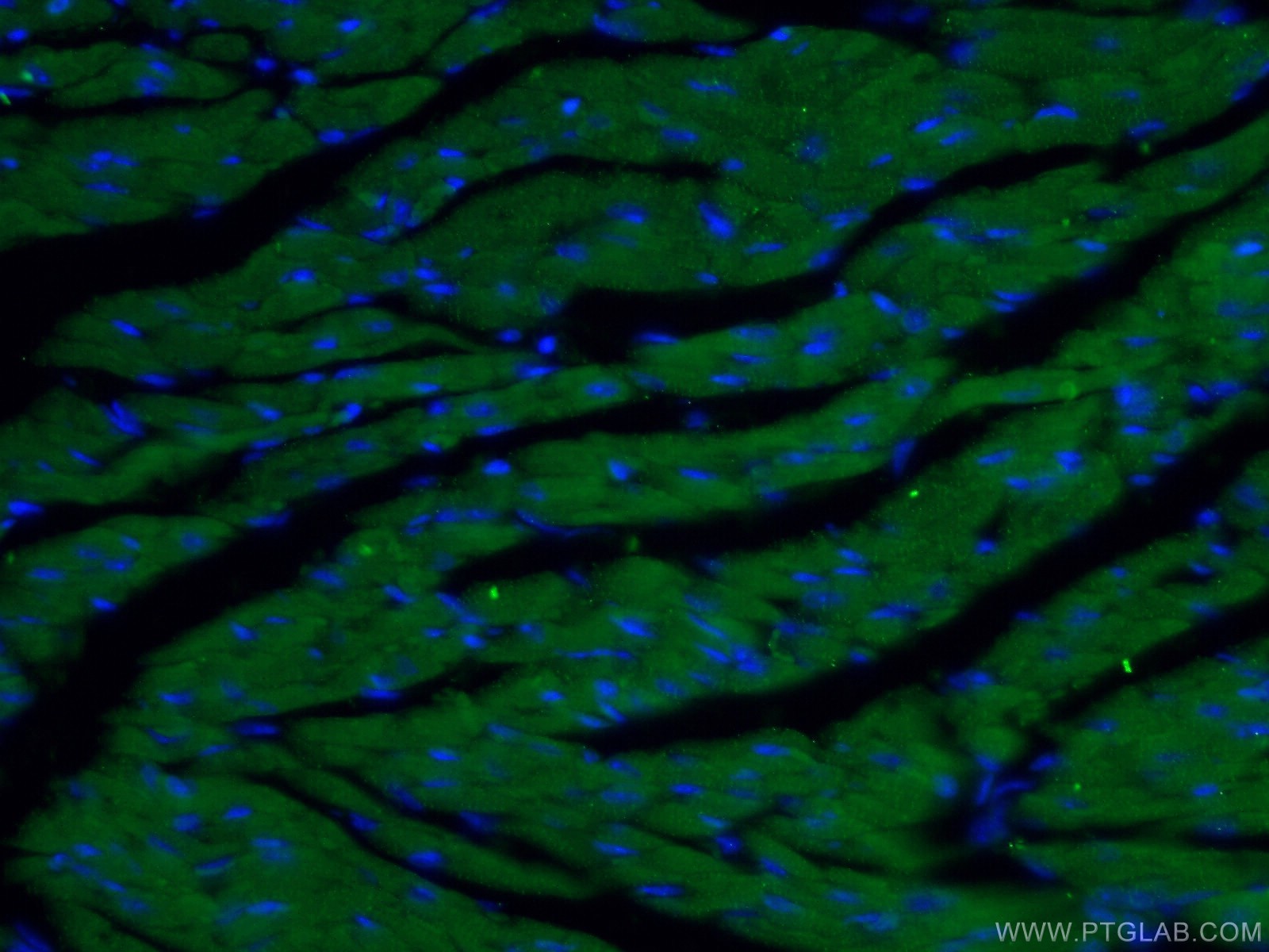 ACTN2 Antibody 14221-1-AP | Proteintech