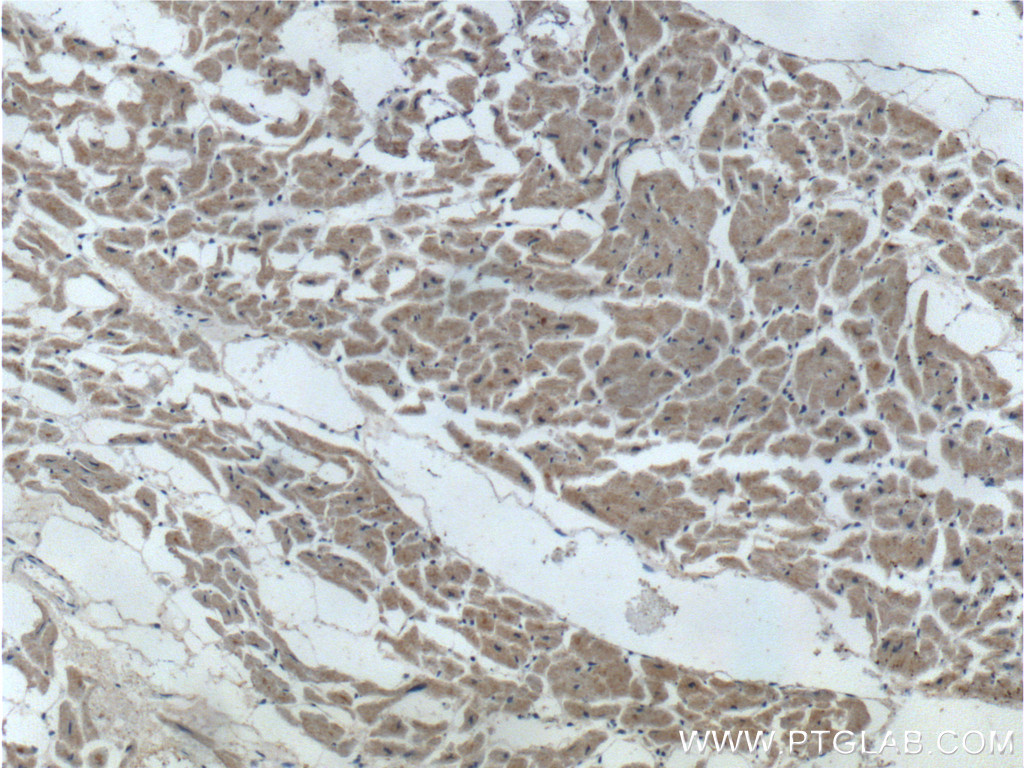 ACTN2 Antibody 14221-1-AP | Proteintech
