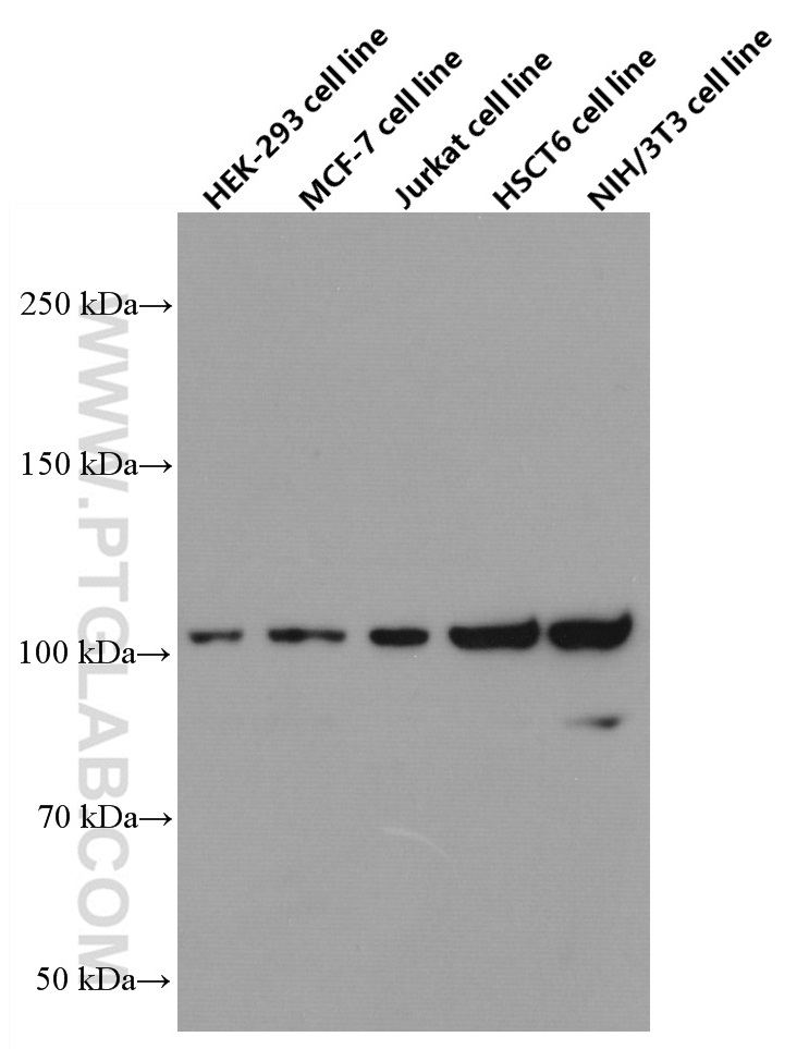 ACTN4 Antibody 66628-1-Ig | Proteintech