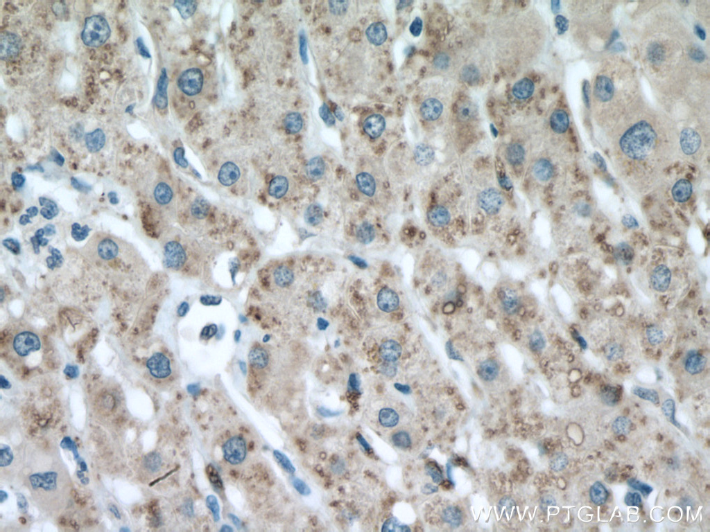 ADRP/Perilipin 2 Antibody 15294-1-AP | Proteintech