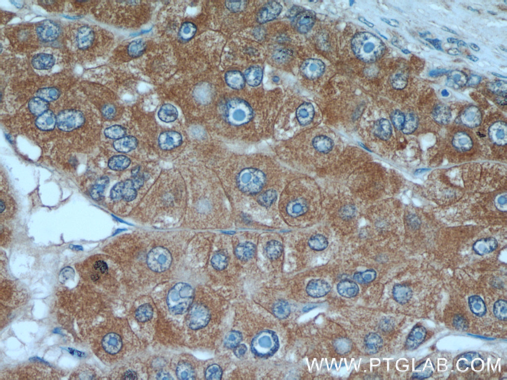 AFP Antibody 14550-1-AP | Proteintech