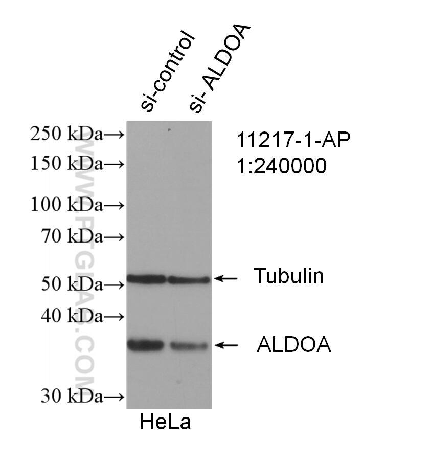 ALDOA Antibody 11217-1-AP | Proteintech