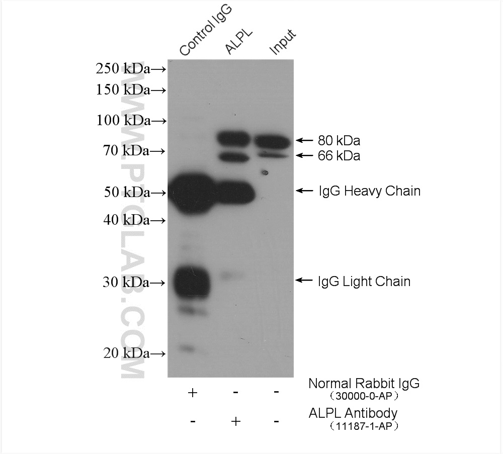 ALPL Antibody 11187-1-AP | Proteintech