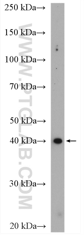 AMD1 Antibody 11052-1-AP | Proteintech