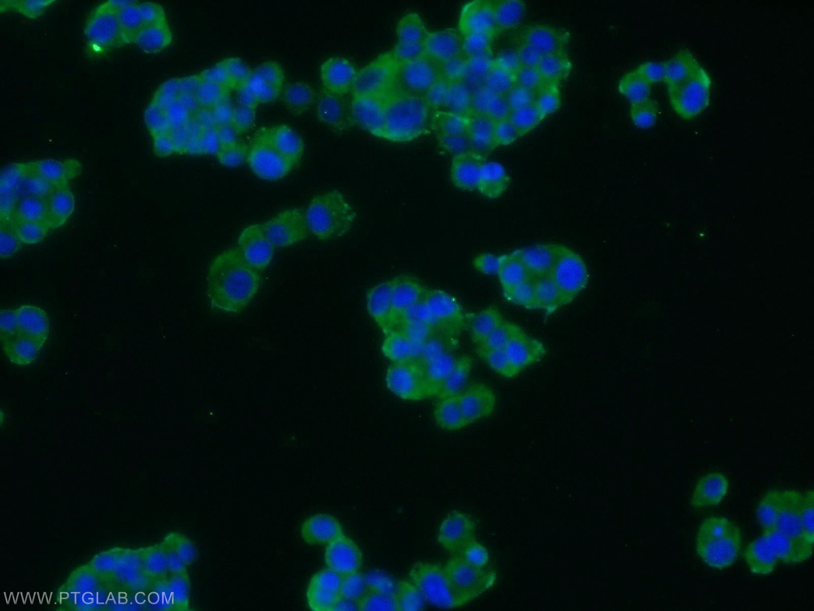 Angiopoietin 2 Antibody 24613-1-AP | Proteintech