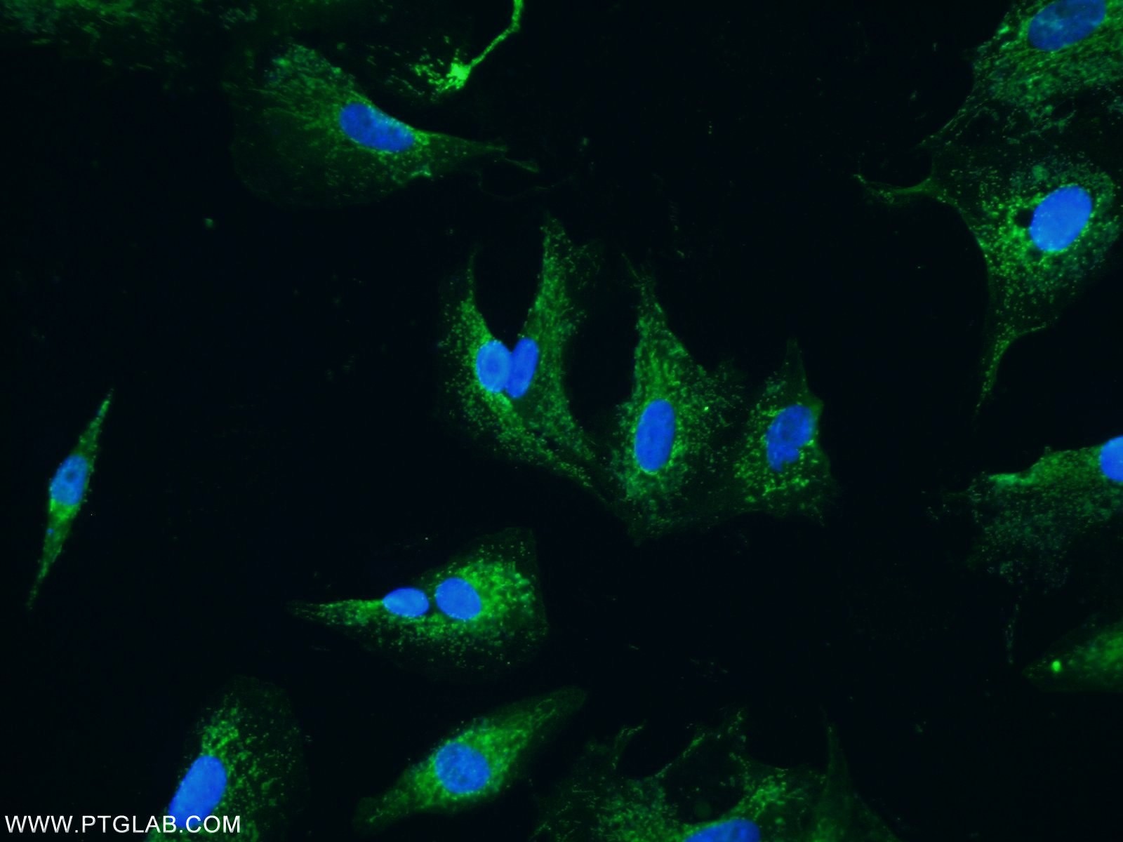 Angiopoietin 2 Antibody 24613-1-AP | Proteintech
