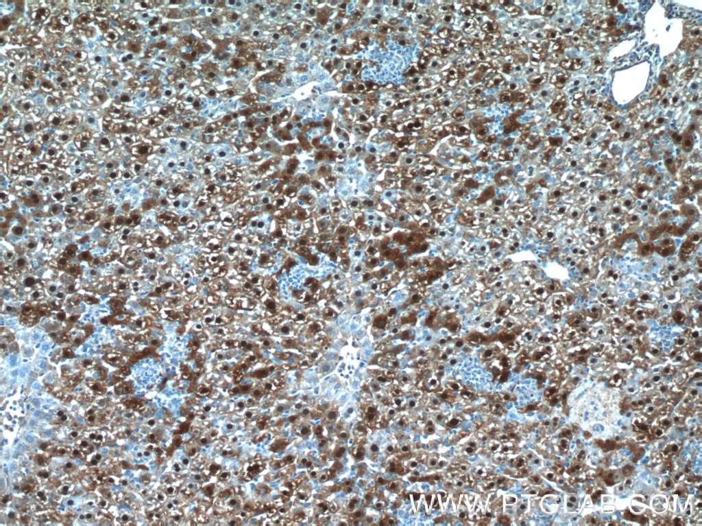 ARG1 Antibody 16001-1-AP | Proteintech