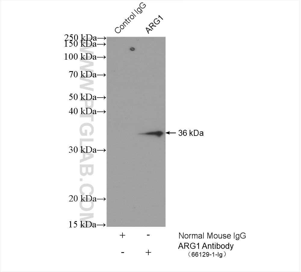 Arginase-1 Antibody 66129-1-Ig | Proteintech