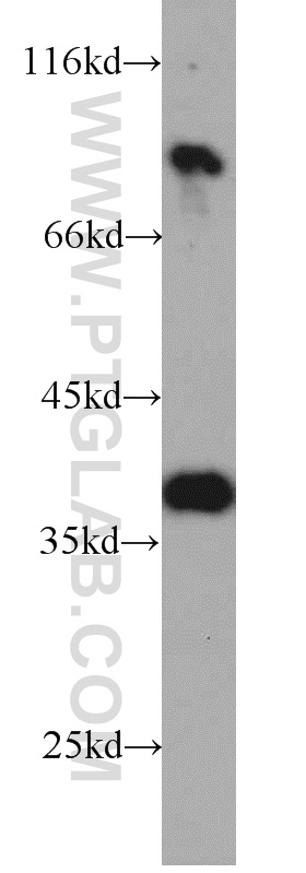 ARG2 Antibody 14825-1-AP | Proteintech