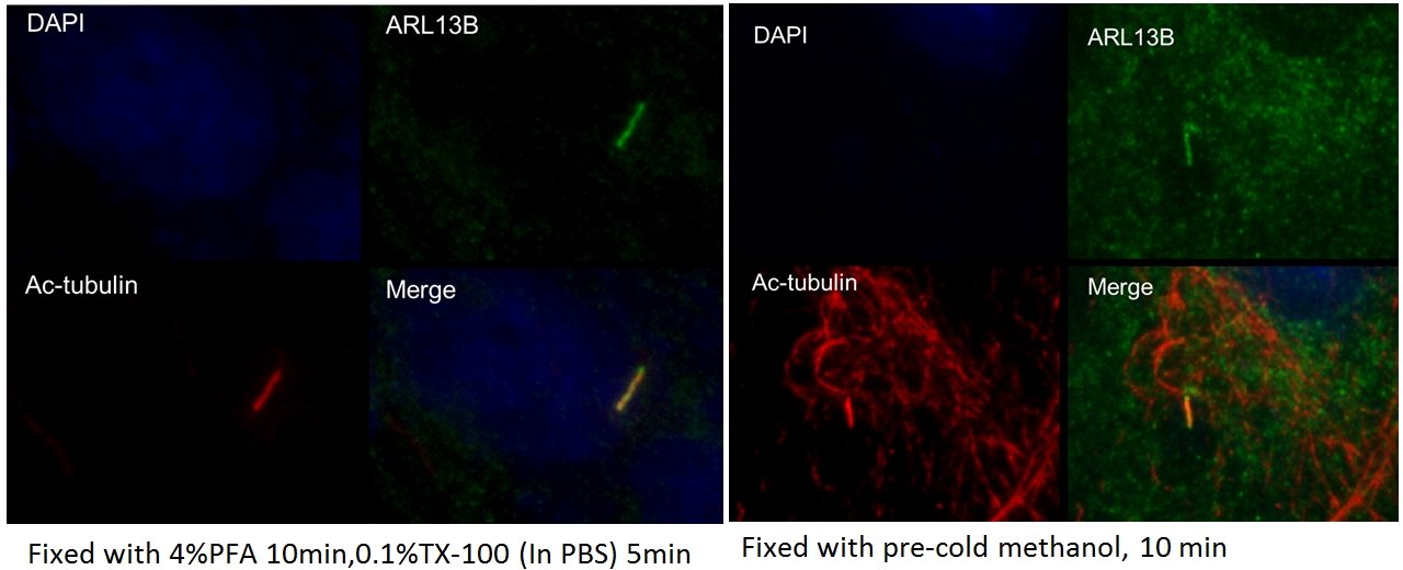 ARL13B Antibody 17711-1-AP | Proteintech