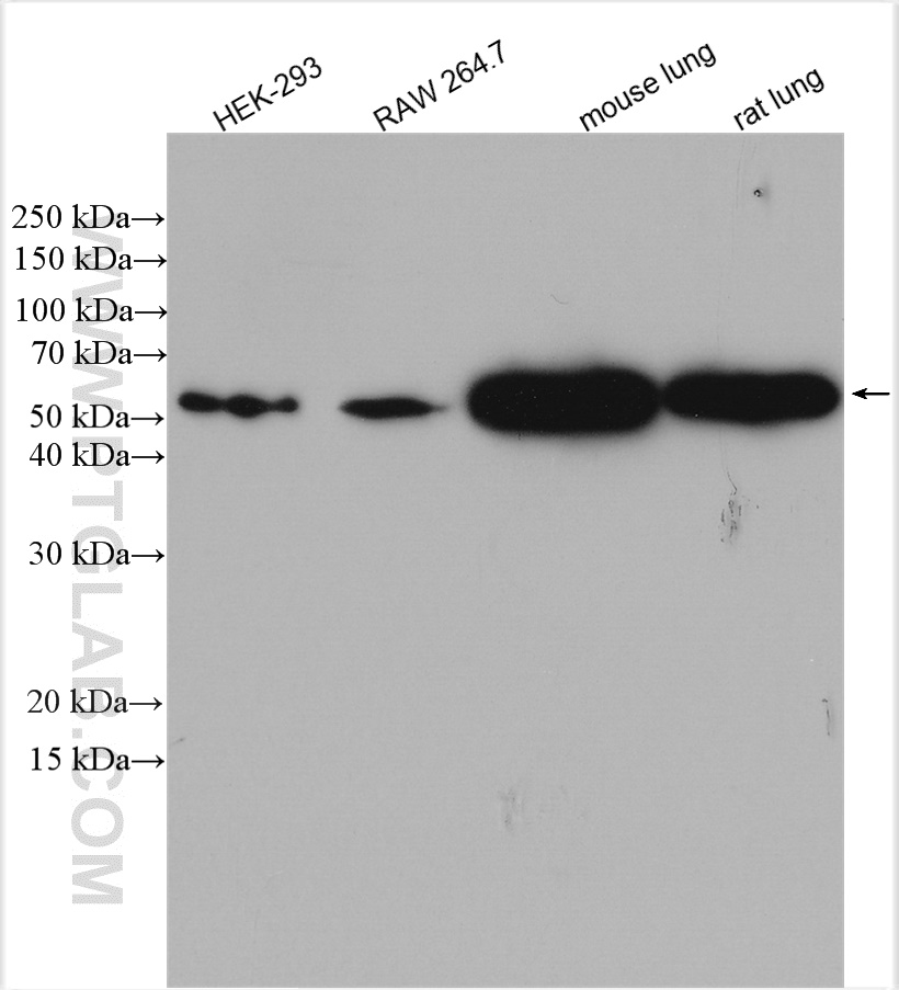 Beta Arrestin 1 Antibody 15361-1-AP | Proteintech