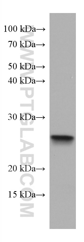 ASC/TMS1 Antibody 67494-1-Ig | Proteintech