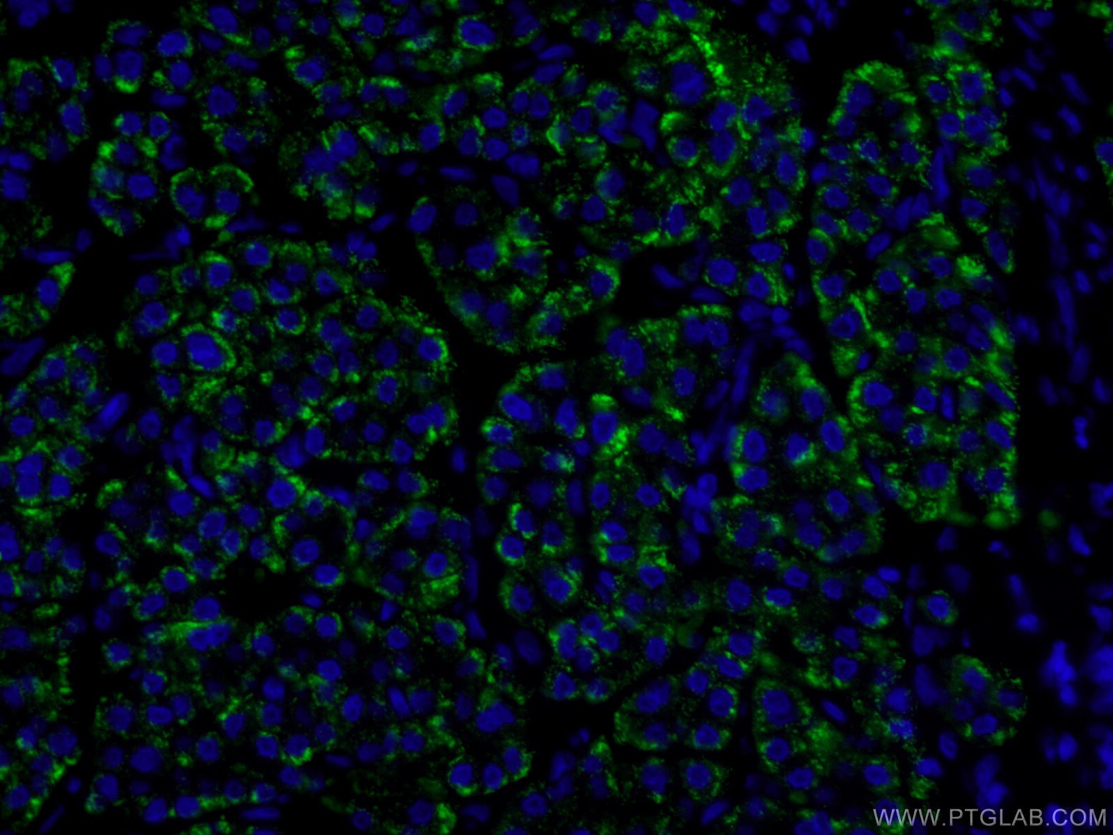 ASGR1 Antibody CL488-11739 | Proteintech