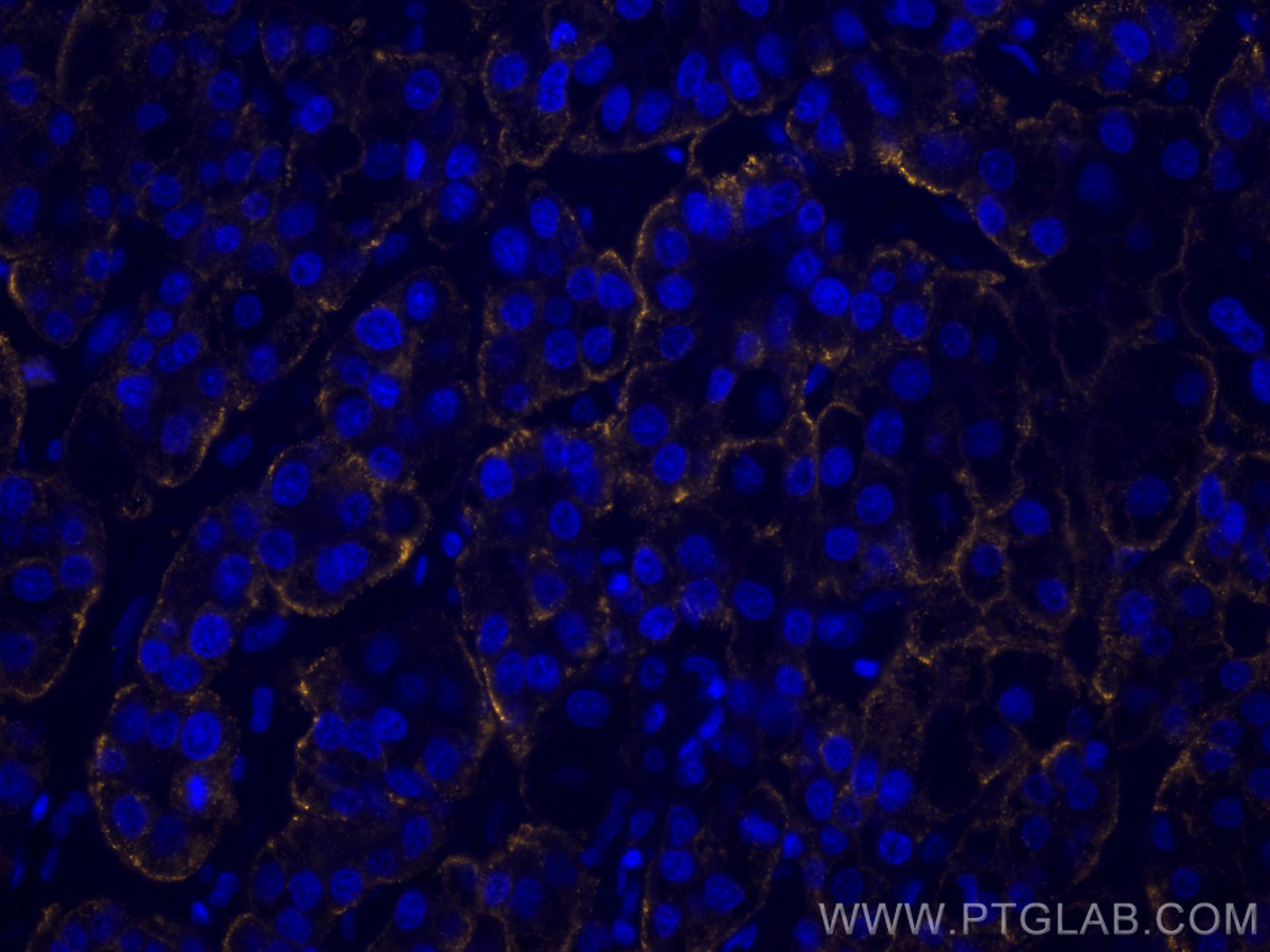 ASGR1 Antibody CL555-11739 | Proteintech