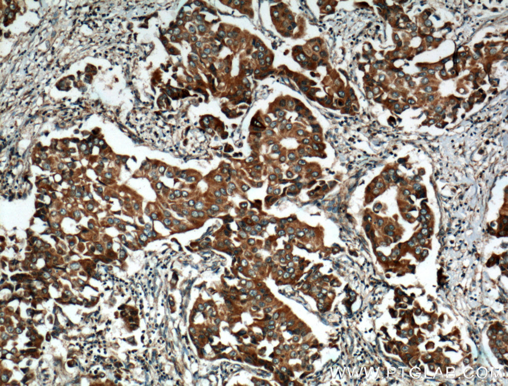 ATF4 Antibody 60035-1-Ig | Proteintech
