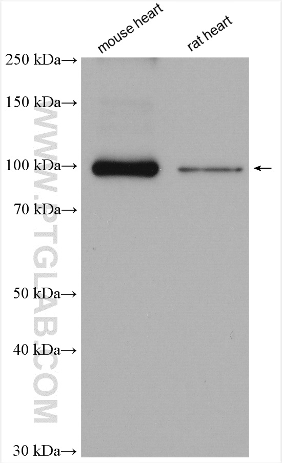 ATP1A1 Antibody 14418-1-AP | Proteintech