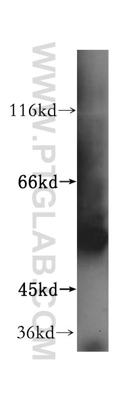 ATPB Antibody 17247-1-AP | Proteintech