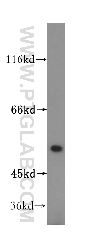 ATPB Antibody 17247-1-AP | Proteintech