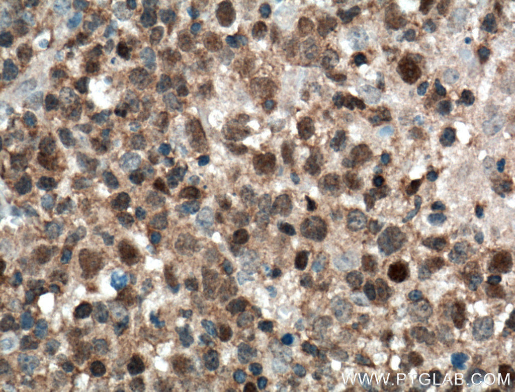 BCL6 Antibody 66340-1-Ig | Proteintech