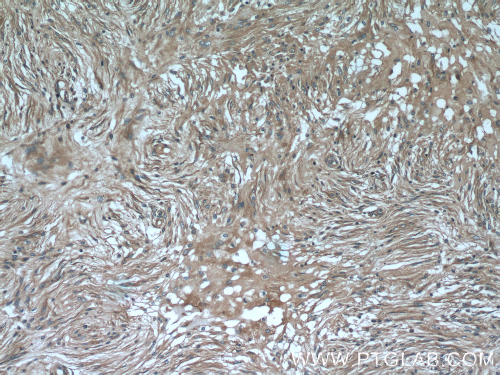 BCRP/ABCG2 Antibody 10051-1-AP | Proteintech