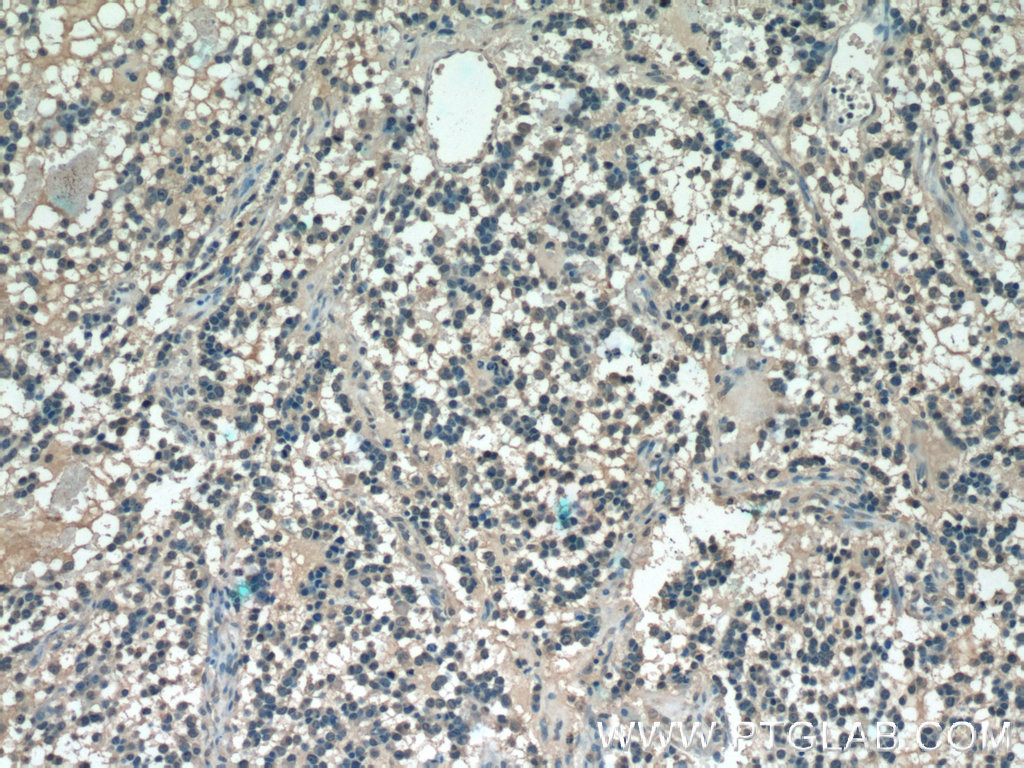 BCRP/ABCG2 Antibody 10051-1-AP | Proteintech