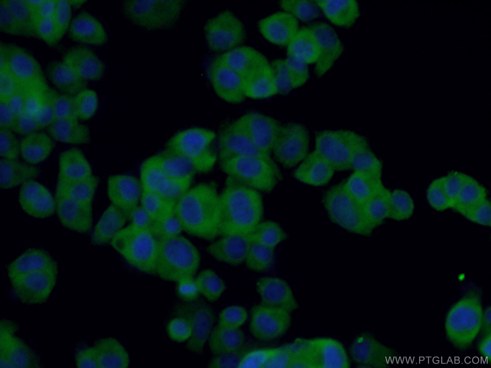 BDNF Antibody 28205-1-AP | Proteintech