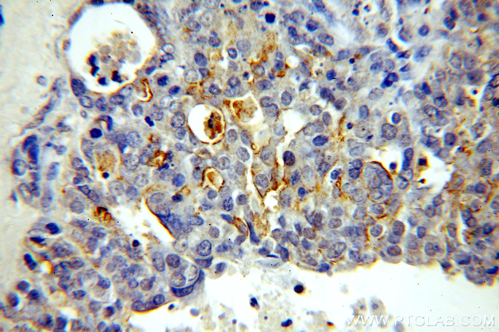 MUC1/CA15-3 N-terminal Antibody 19976-1-AP | Proteintech