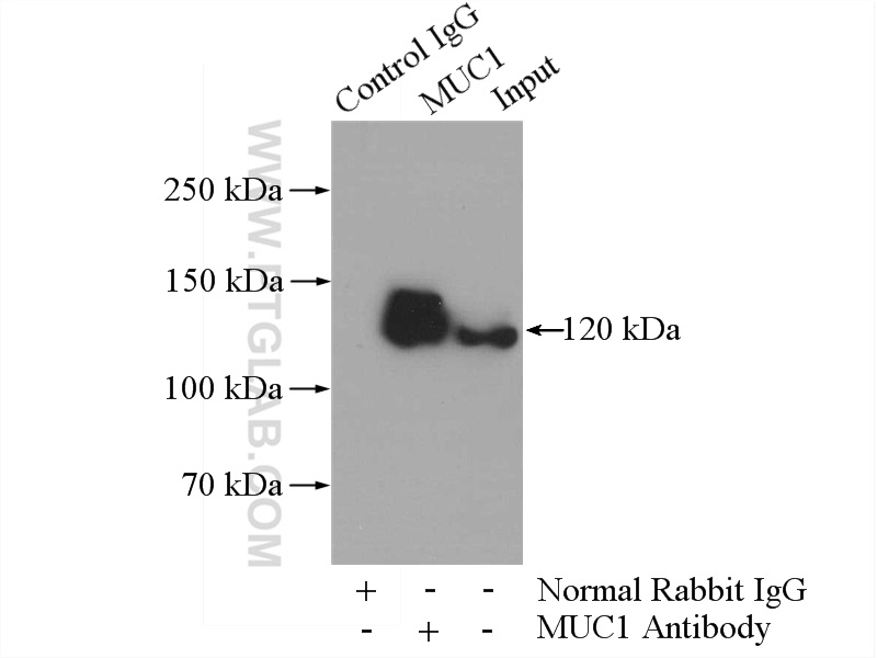 MUC1/CA15-3 N-terminal Antibody 19976-1-AP | Proteintech