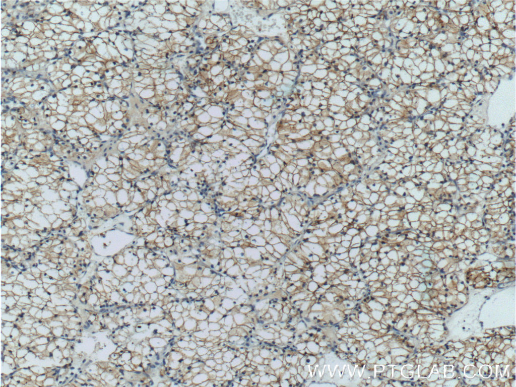 CA9 Antibody 11071-1-AP | Proteintech