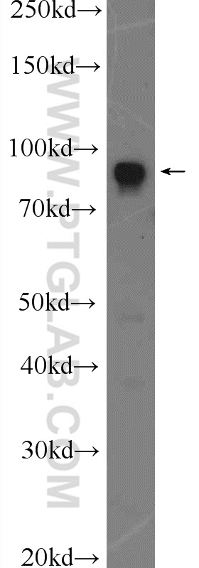 Calnexin Antibody 10427-2-AP | Proteintech