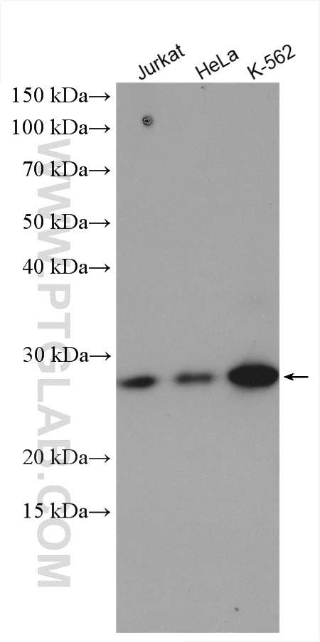 CBP,EIF4E Antibody 11149-1-AP | Proteintech