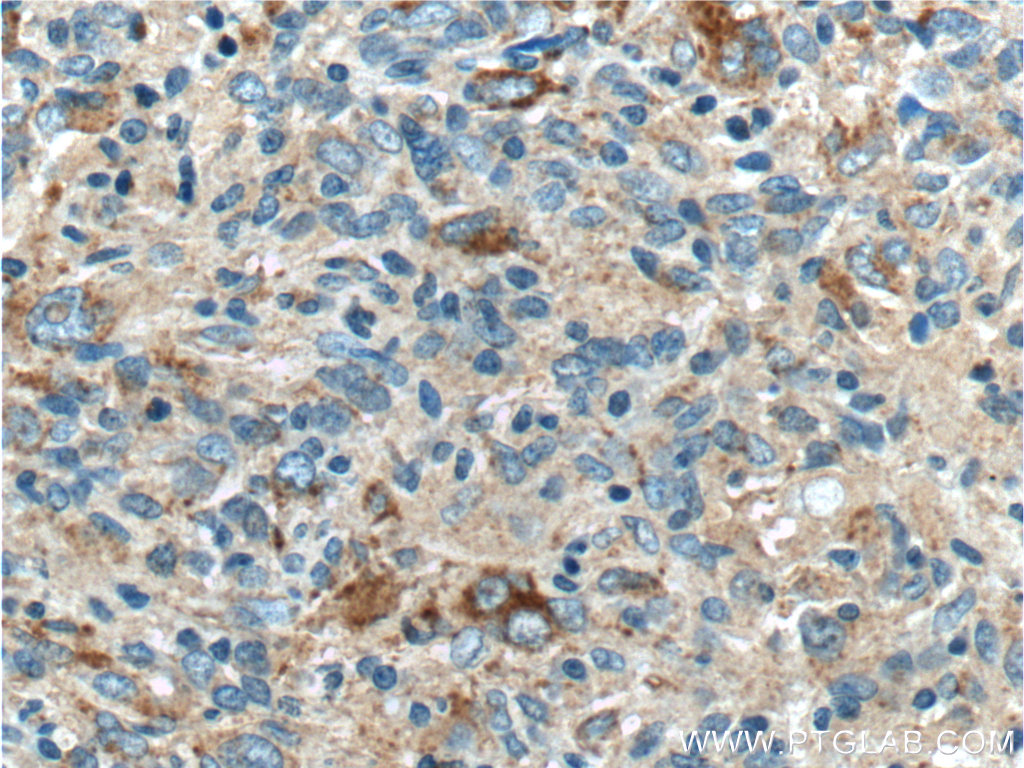 LAMP1 Antibody 21997-1-AP | Proteintech